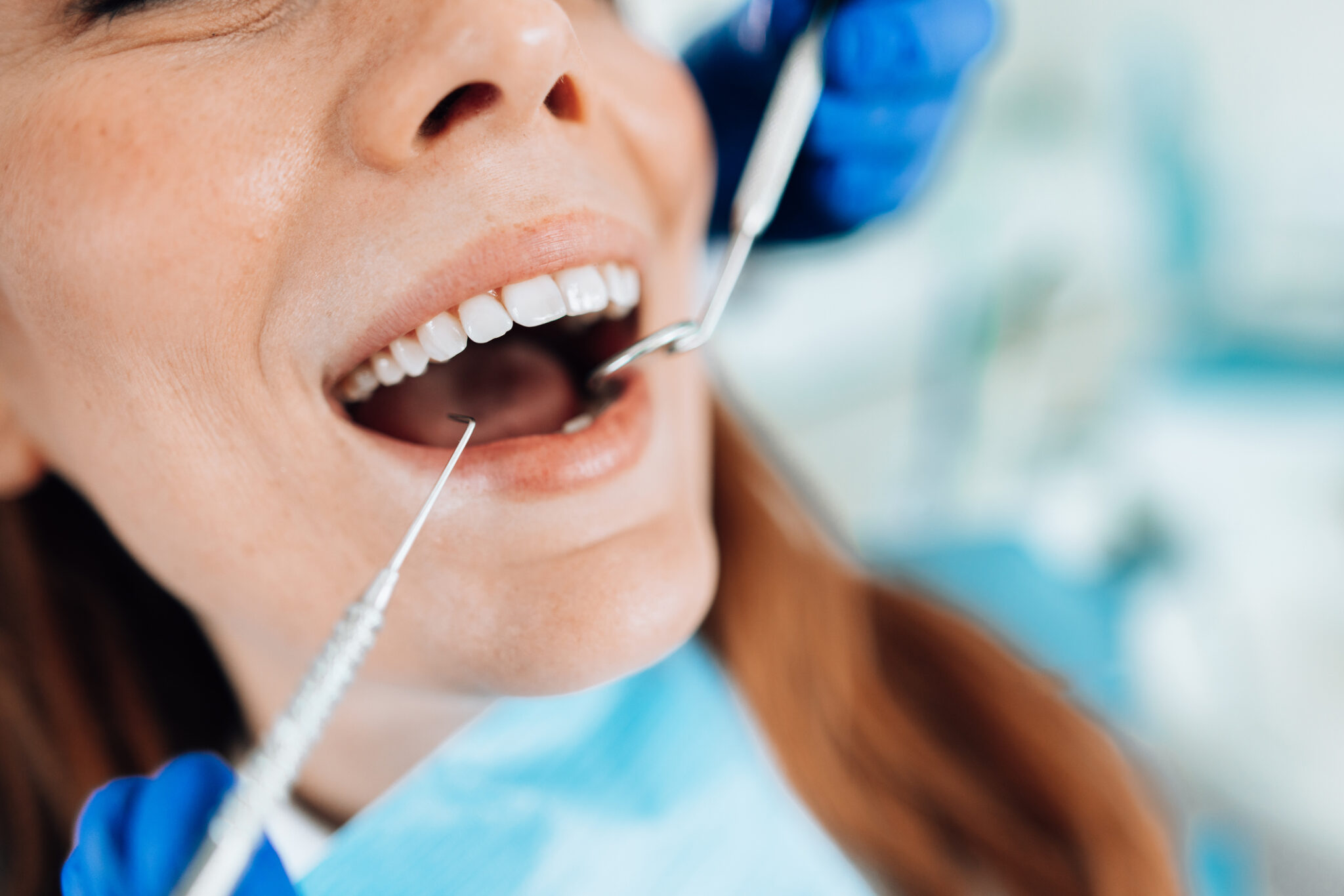 Vitamin D Supplementation for Deficiency & Strong Teeth
